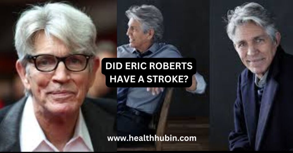 Did Eric Roberts Have a Stroke | 3 Times Shocking Injuries